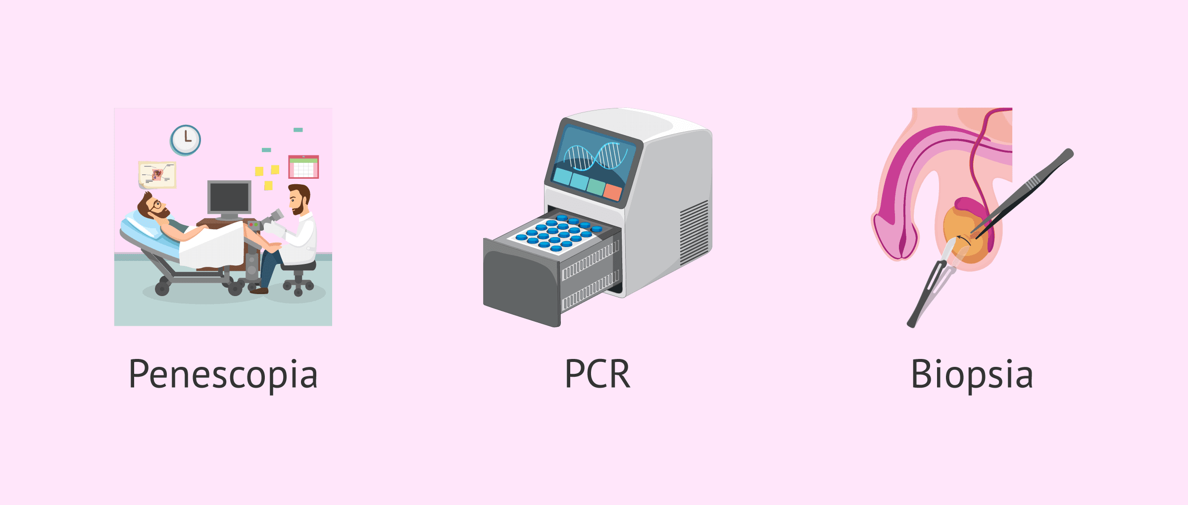Infección por el Virus del Papiloma Humano (VPH) en los hombres